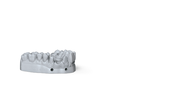 NextDent Model Resin - Grey (NEW)– Ultimate 3D Printing Store